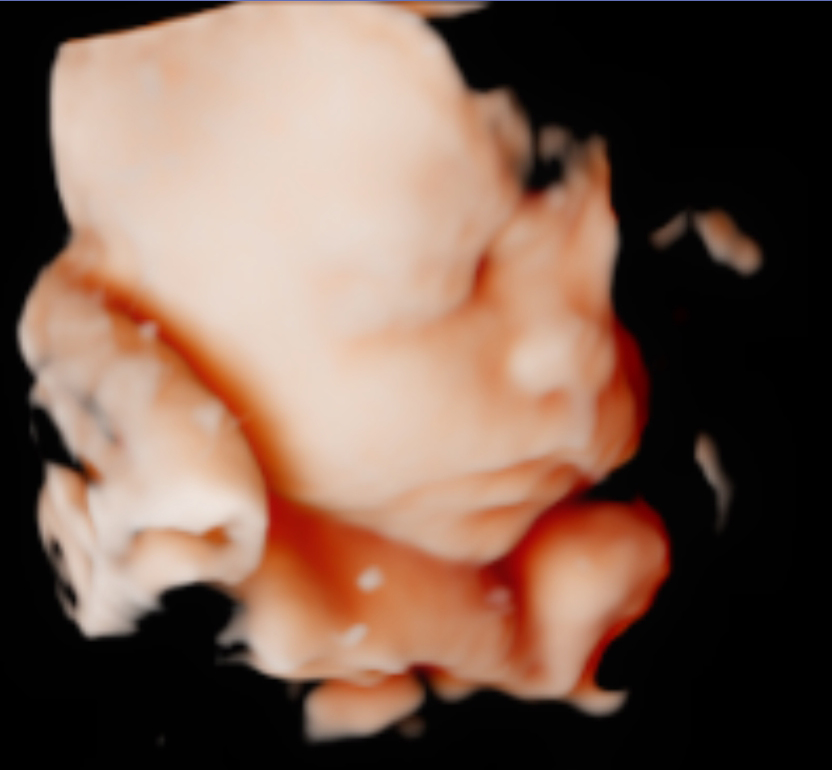 Echo Praktijk - B-Flow Echo Praktijk