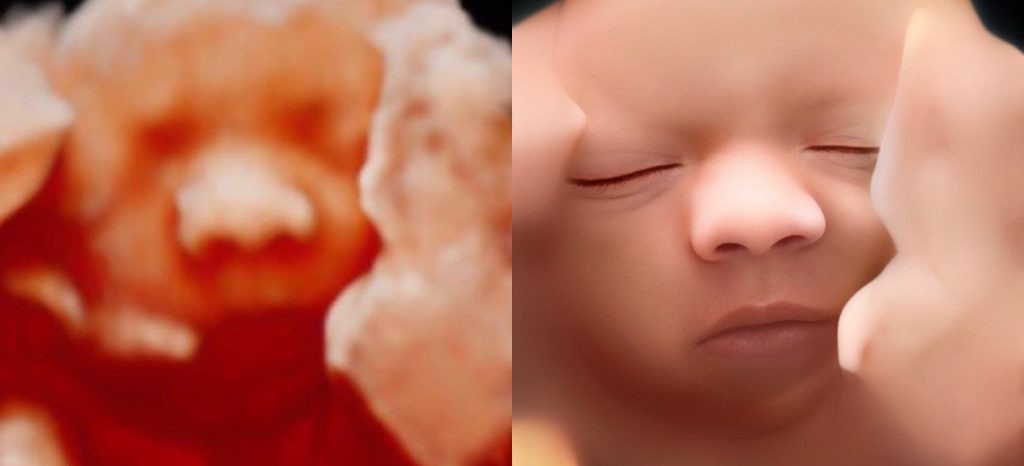 6D echopakket - B-Flow Echo Praktijk